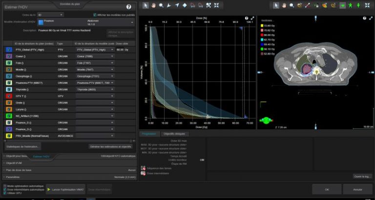 Troisième modèle Varian RapidPlan mis en place au CGLC - Centre de ...